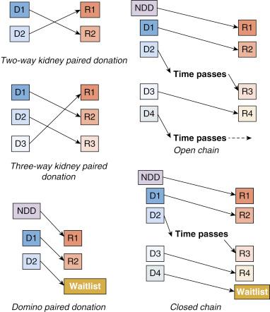 Paired Exchange Programs for Living Donors - Clinical Tree