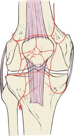 Patella Fractures and Extensor Mechanism Injuries - Clinical Tree