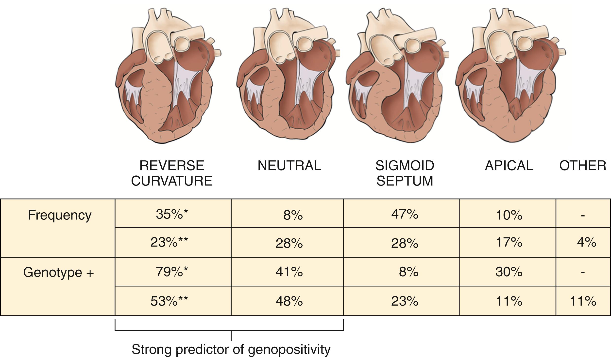 Pathophysiology and Variants of Hypertrophic Cardiomyopathy - Clinical Tree