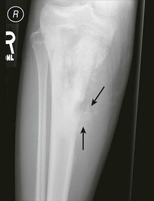 Patterns in Radiology - Clinical Tree