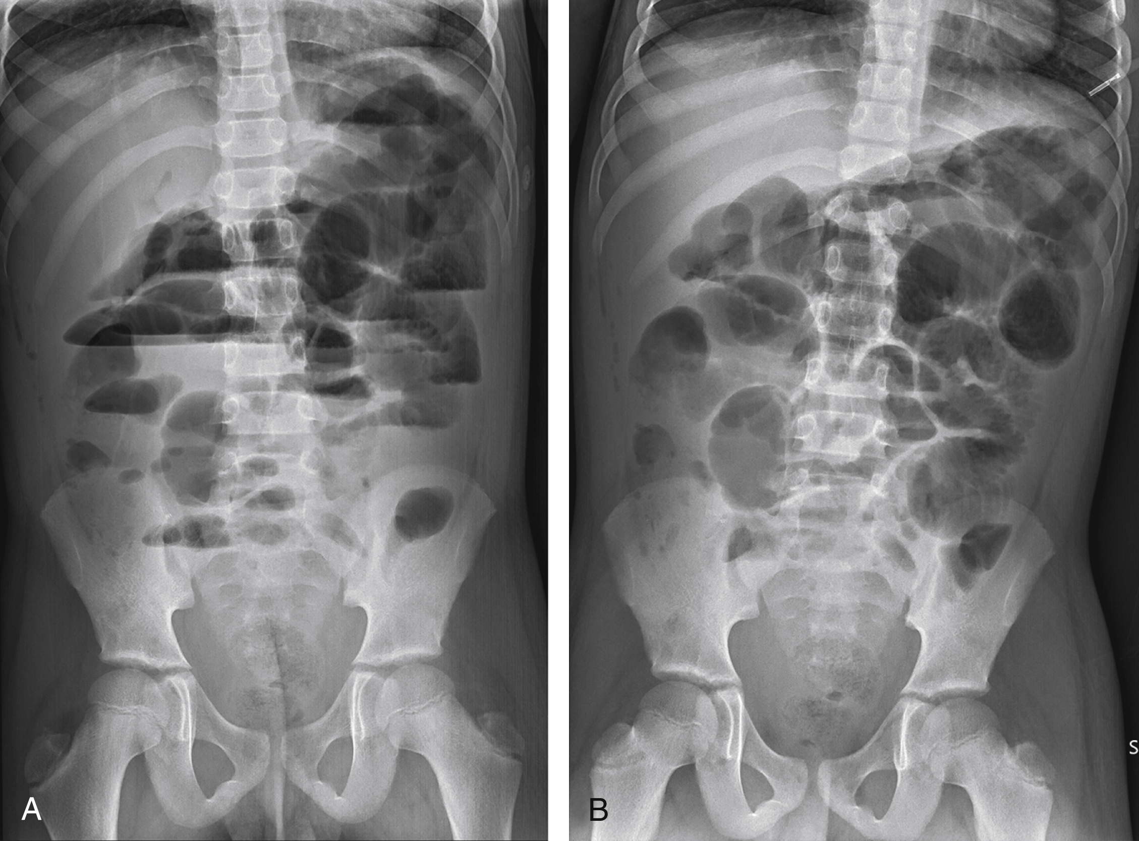 Pediatric Abdominal Pain - Clinical Tree