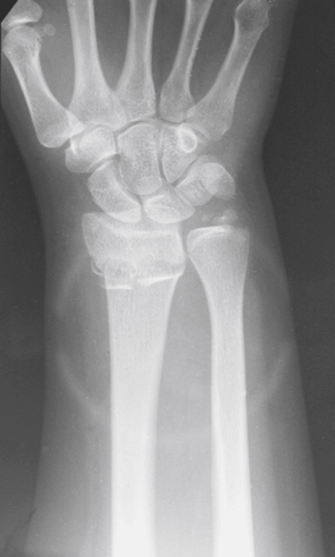 Pediatric Musculoskeletal Disorders - Clinical Tree