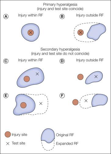 Peripheral Mechanisms of Cutaneous Nociception - Clinical Tree
