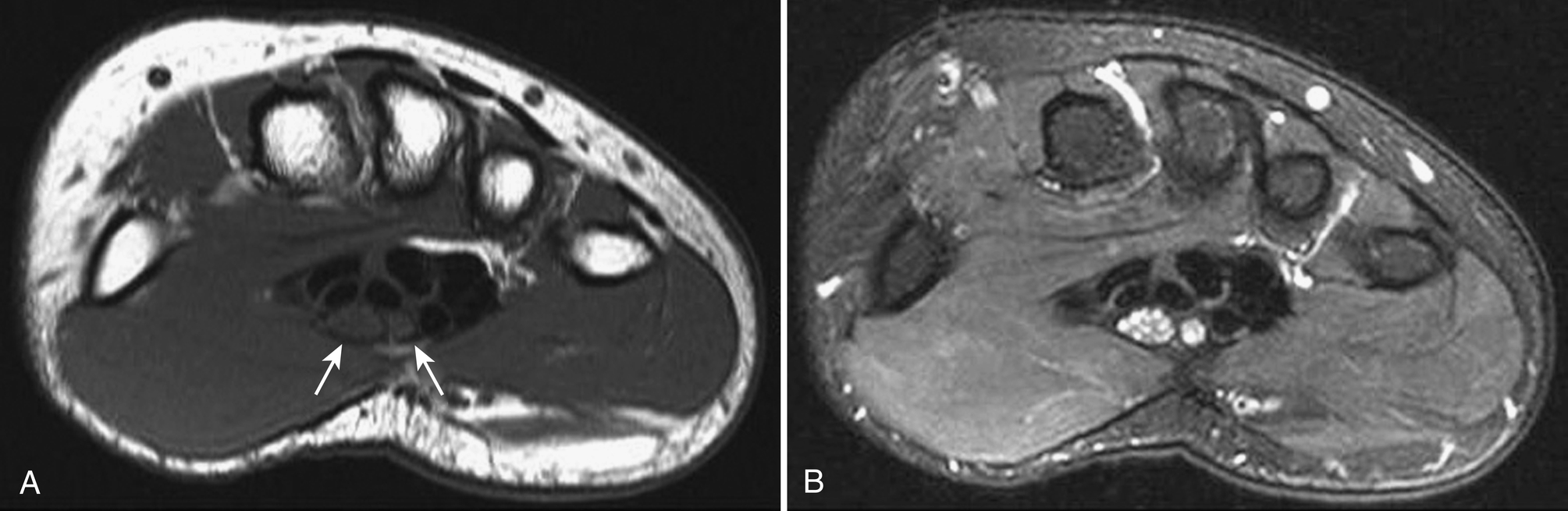 Peripheral Nerves - Clinical Tree