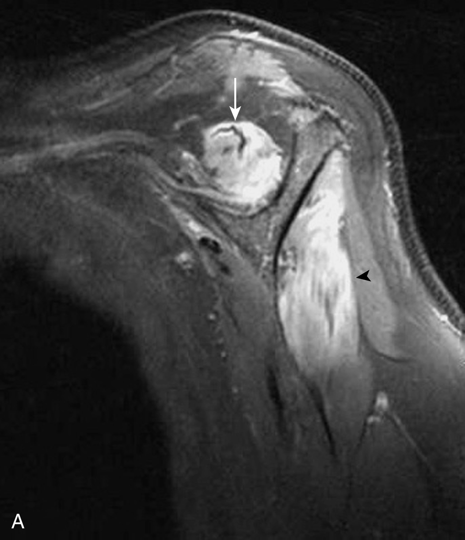 Peripheral Nerves - Clinical Tree