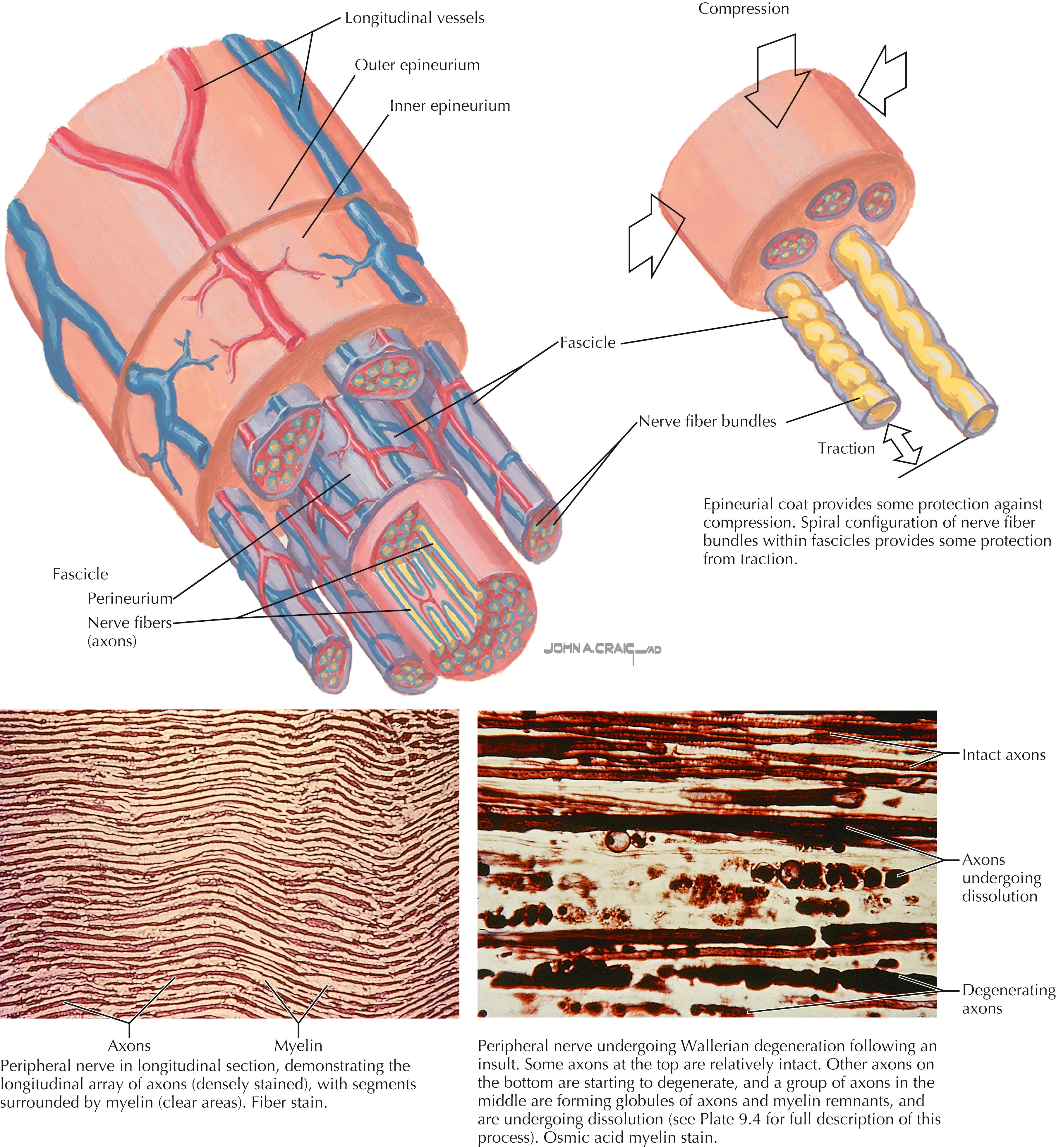 Peripheral Nervous System - Clinical Tree