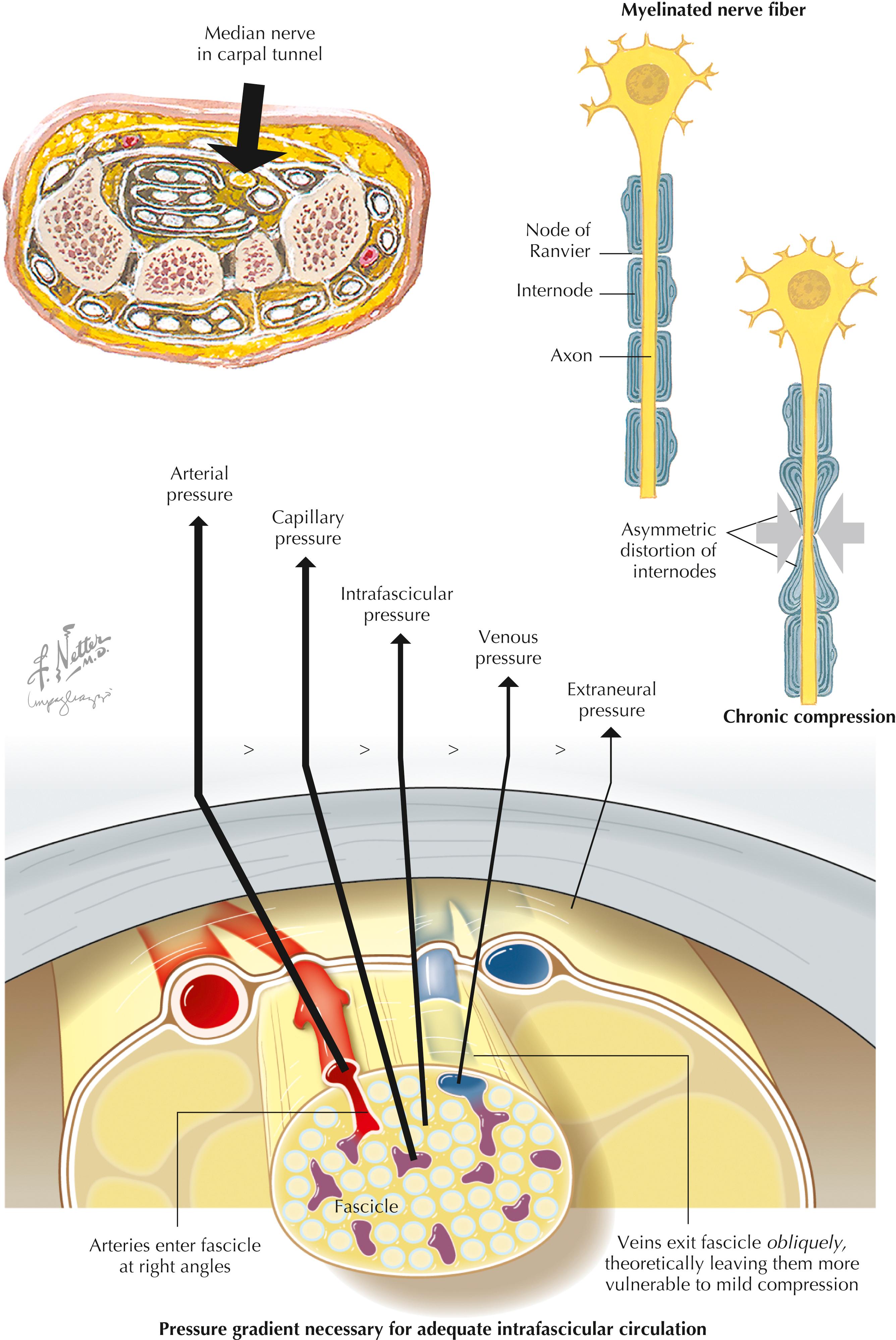 Peripheral Nervous System - Clinical Tree