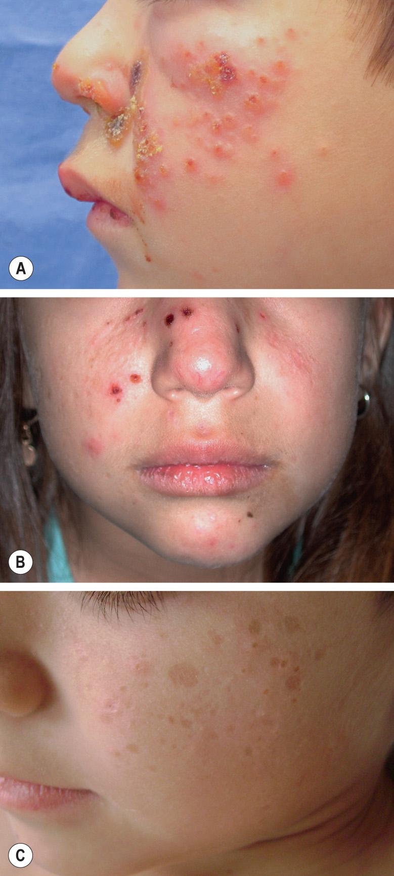 Photodermatologic Disorders - Clinical Tree