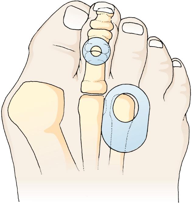 Podiatric Procedures - Clinical Tree