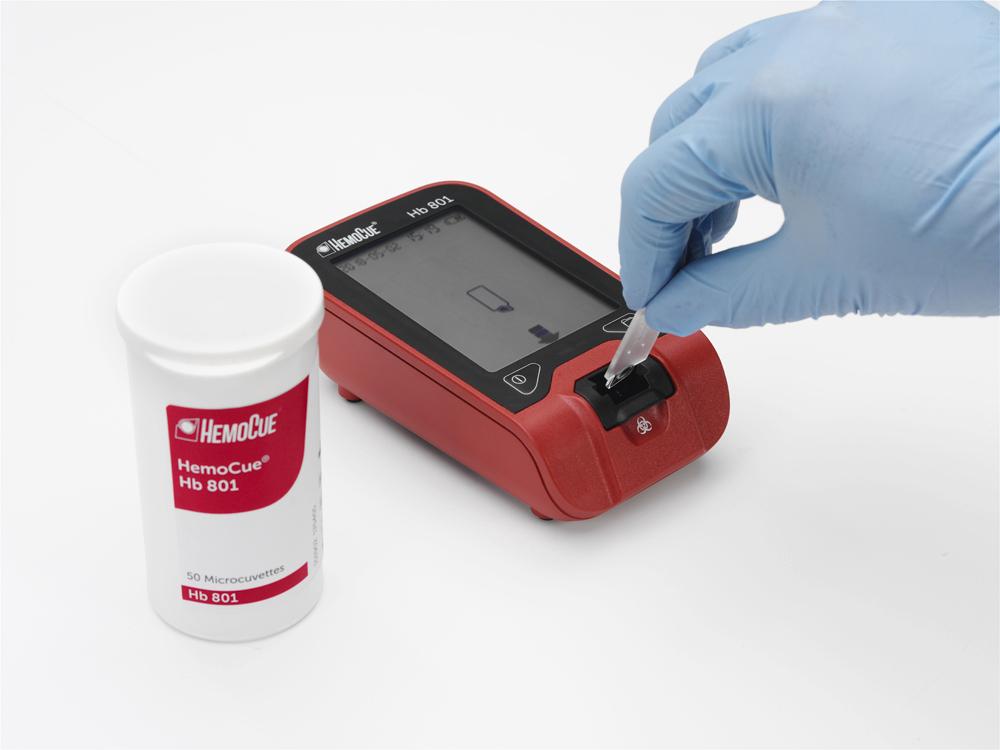 Point-of-care testing - Clinical Tree