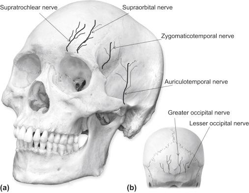 Postcraniotomy Pain - Clinical Tree