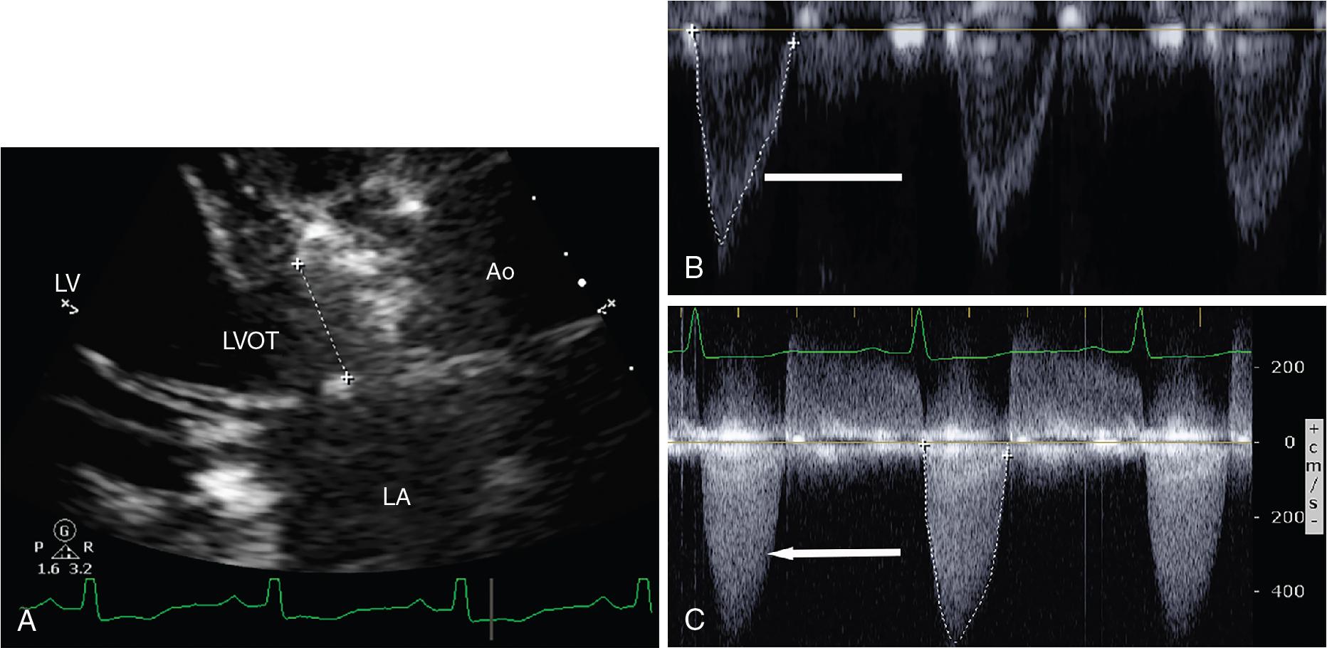 Preprocedural imaging - Clinical Tree