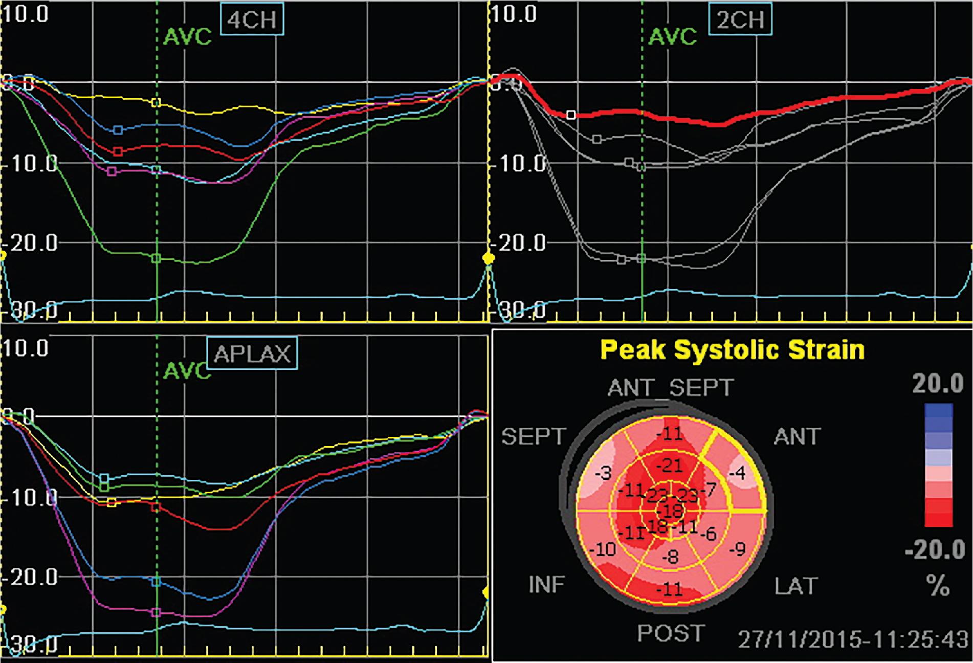 Preprocedural imaging - Clinical Tree