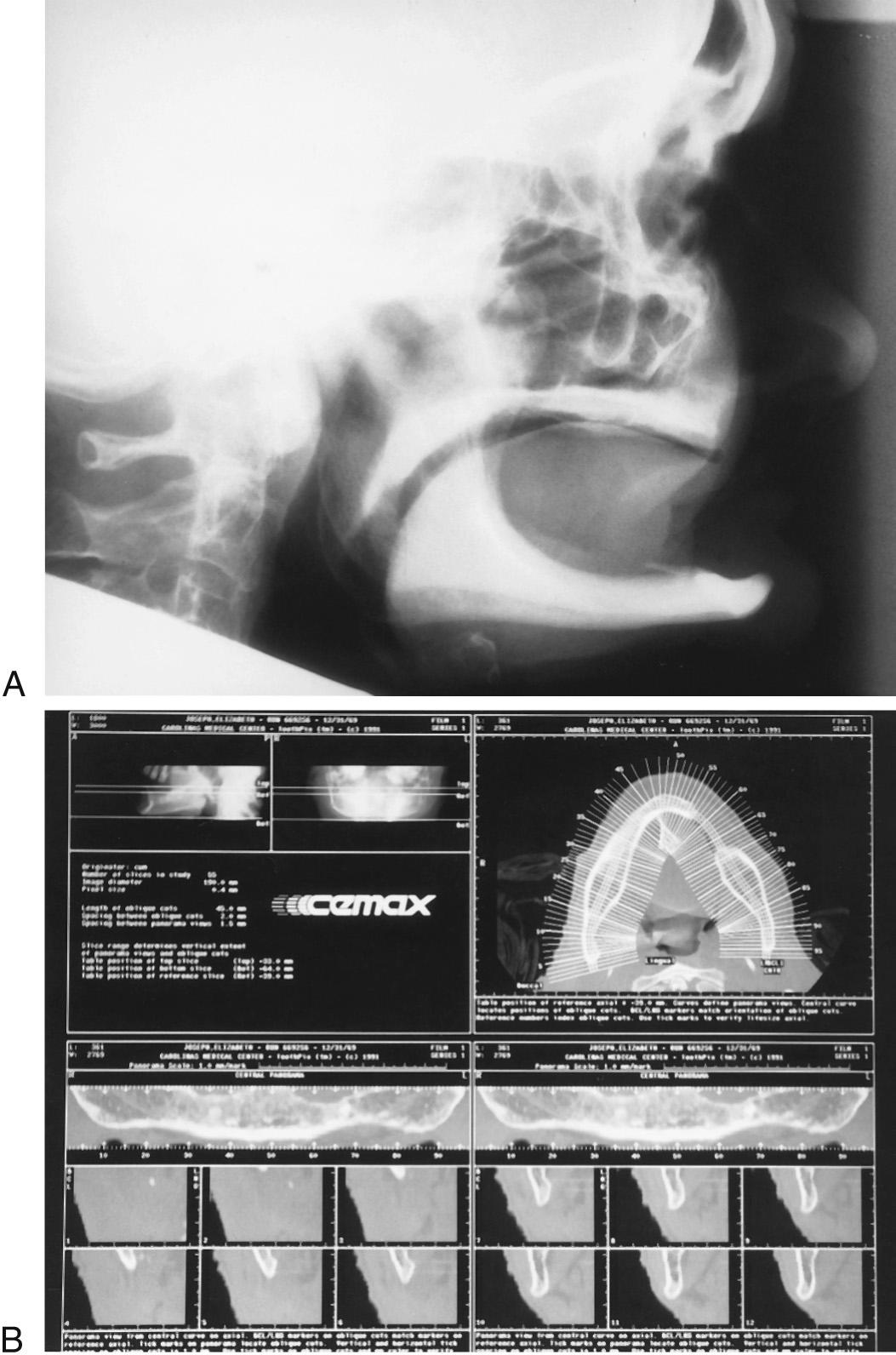 Preprosthetic Surgery - Clinical Tree