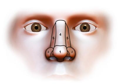 Primary Repair of Soft Tissue Injury and Soft Tissue Defects - Clinical ...