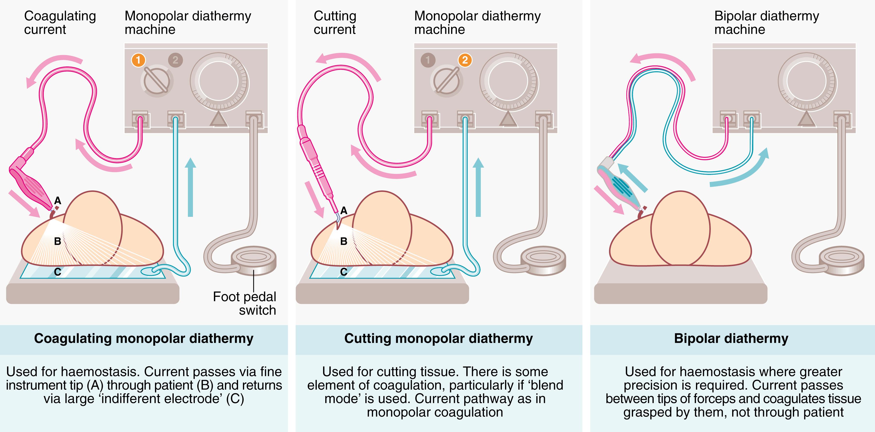 Principles and Techniques of Operative Surgery Including Neurosurgery ...