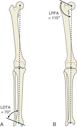 Principles of Deformity Correction - Clinical Tree