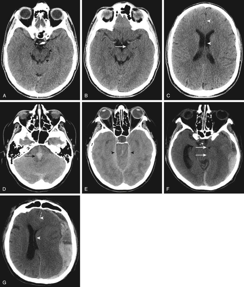 Principles of Modern Neuroimaging - Clinical Tree