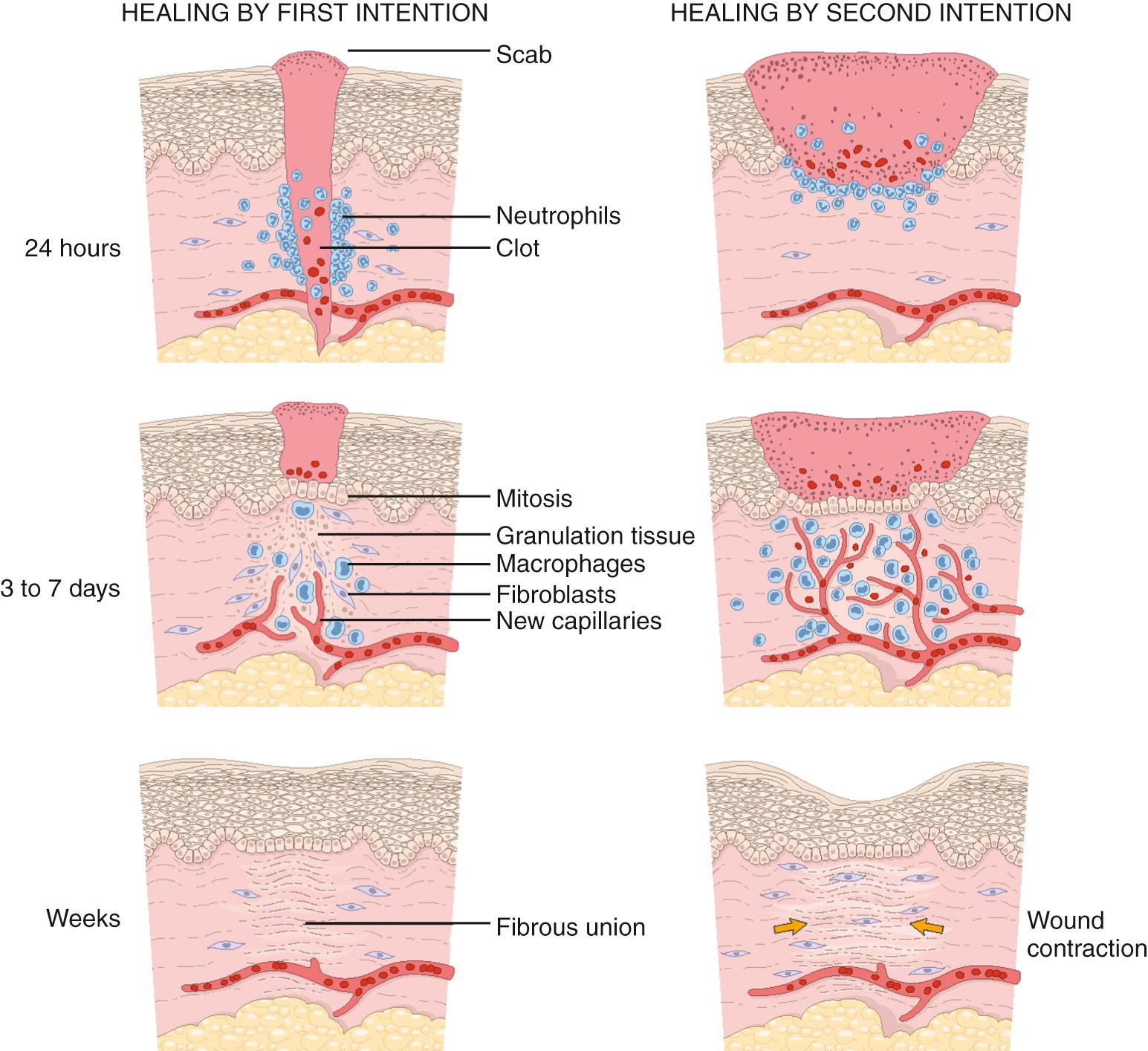 Principles of Wound Management - Clinical Tree