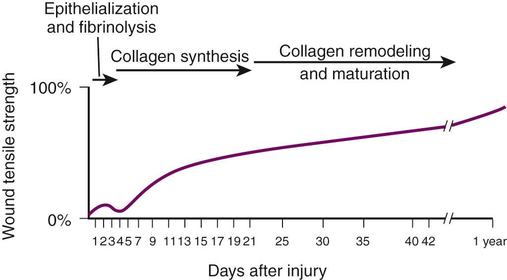 Principles of Wound Management - Clinical Tree