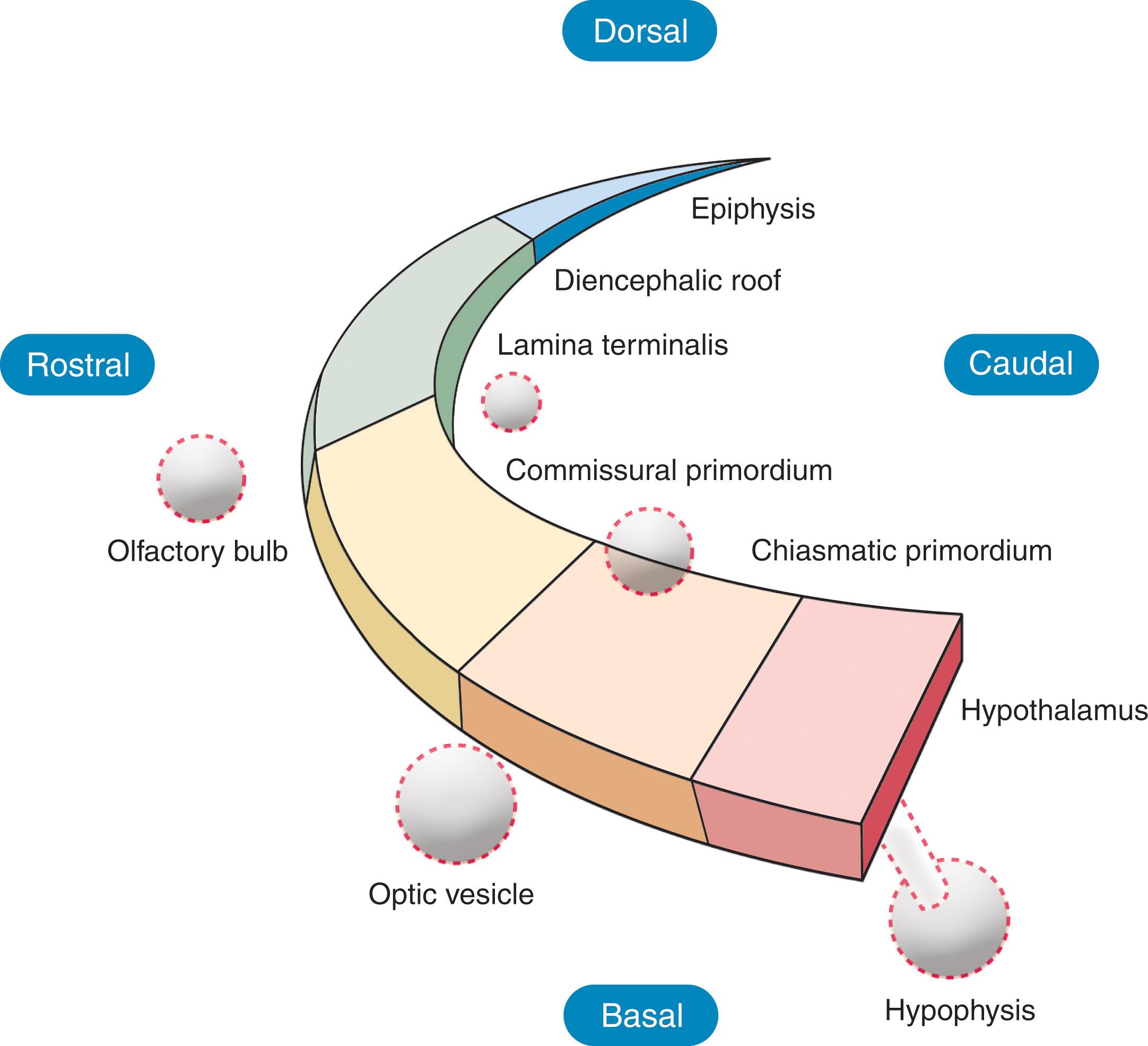 Prosencephalic Development - Clinical Tree