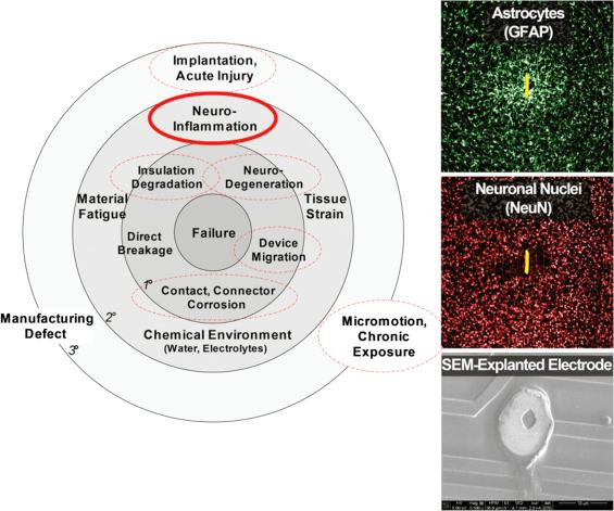 Prospects for a Robust Cortical Recording Interface - Clinical Tree