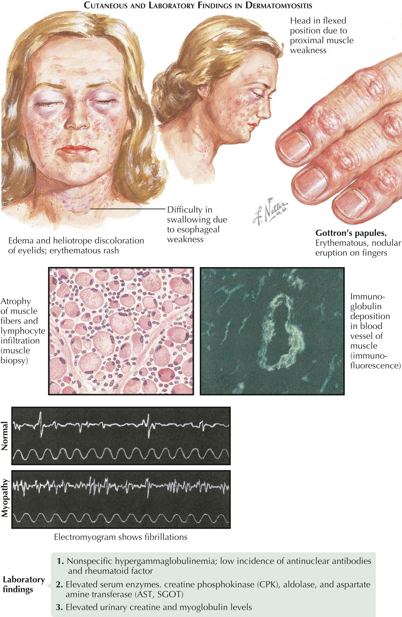 Rashes - Clinical Tree