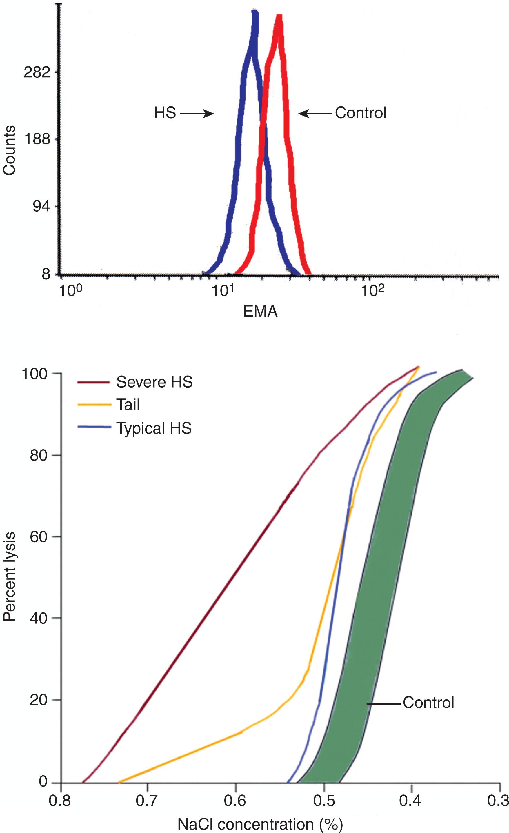 Red Blood Cell Membrane Disorders - Clinical Tree