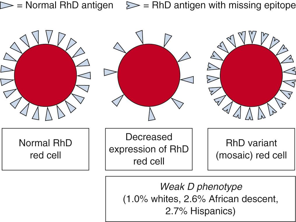Red Cell Alloimmunization - Clinical Tree
