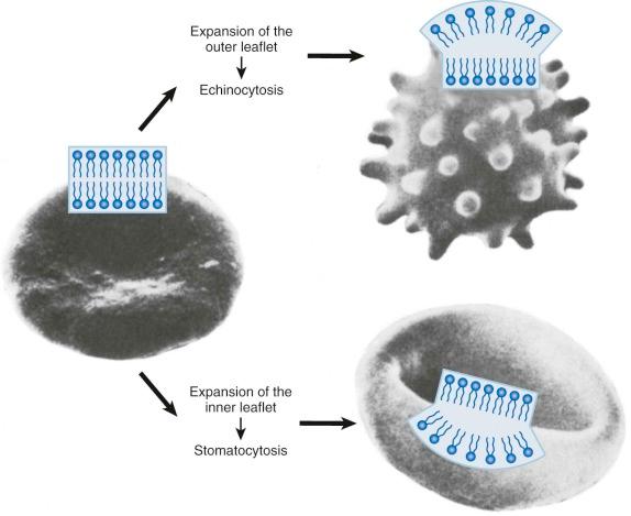 Red Cell Membrane - Clinical Tree