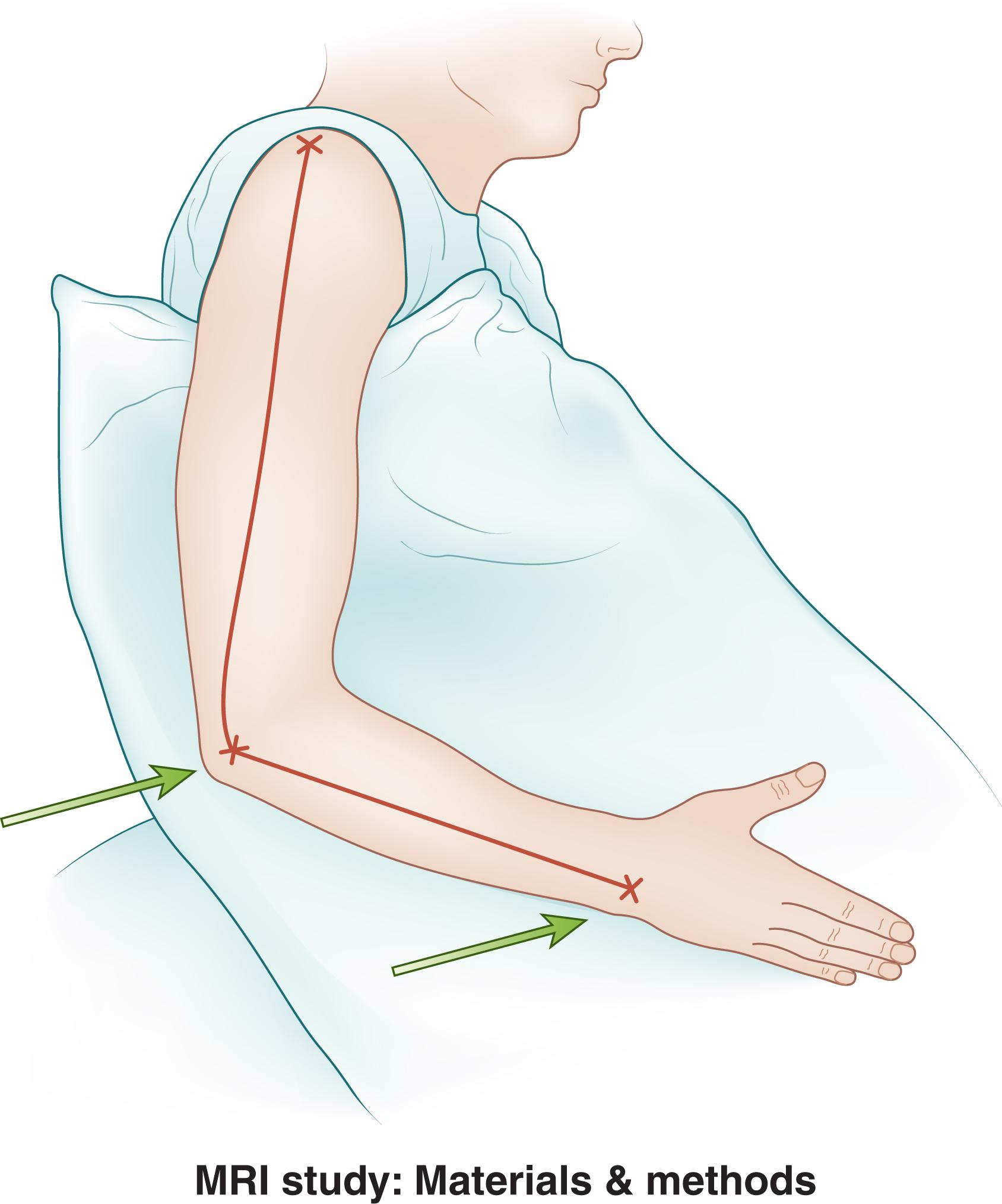 Refining Planning of Lymphedema Surgery of the Extremities Using MRI ...