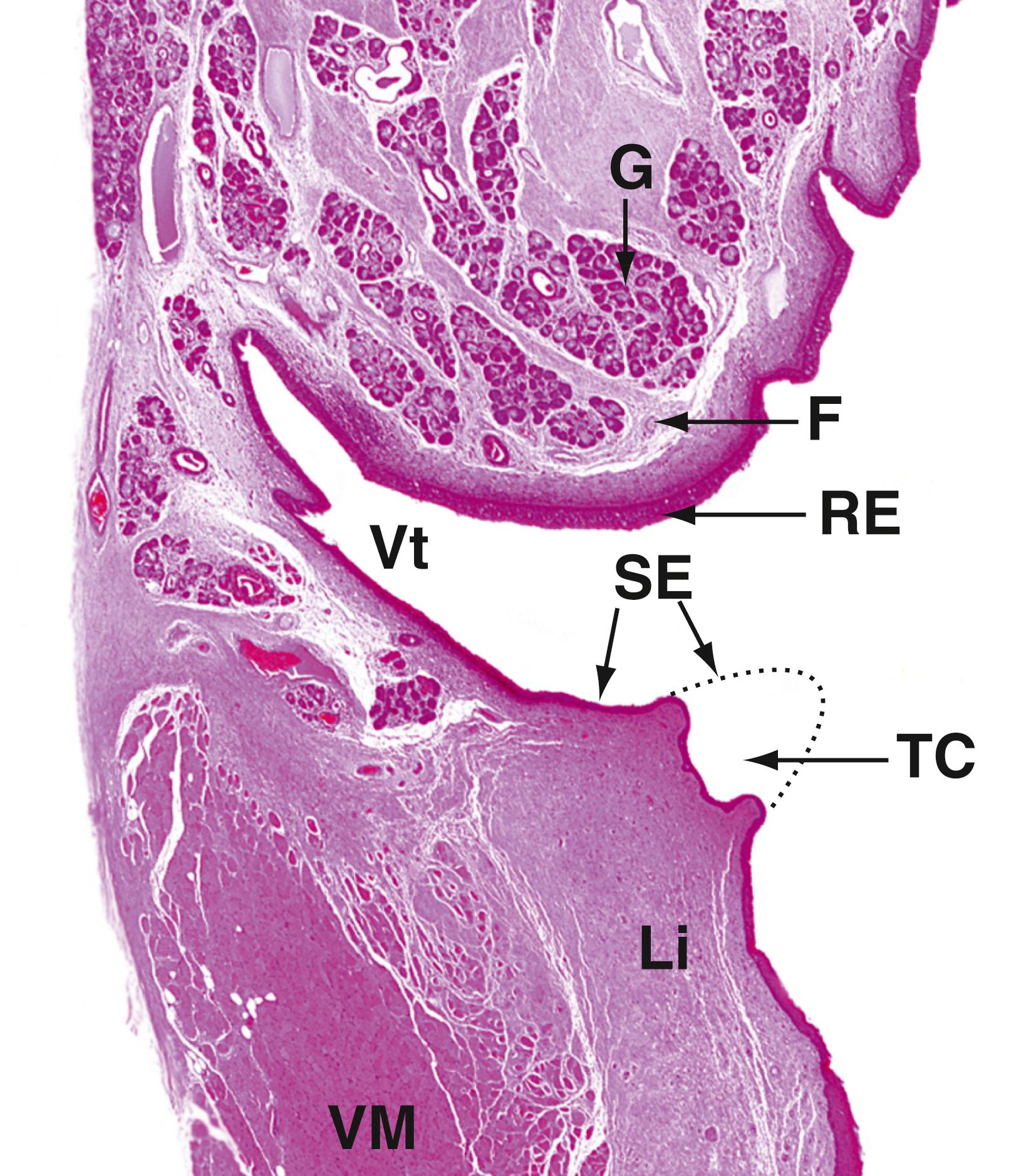 Respiratory System - Clinical Tree