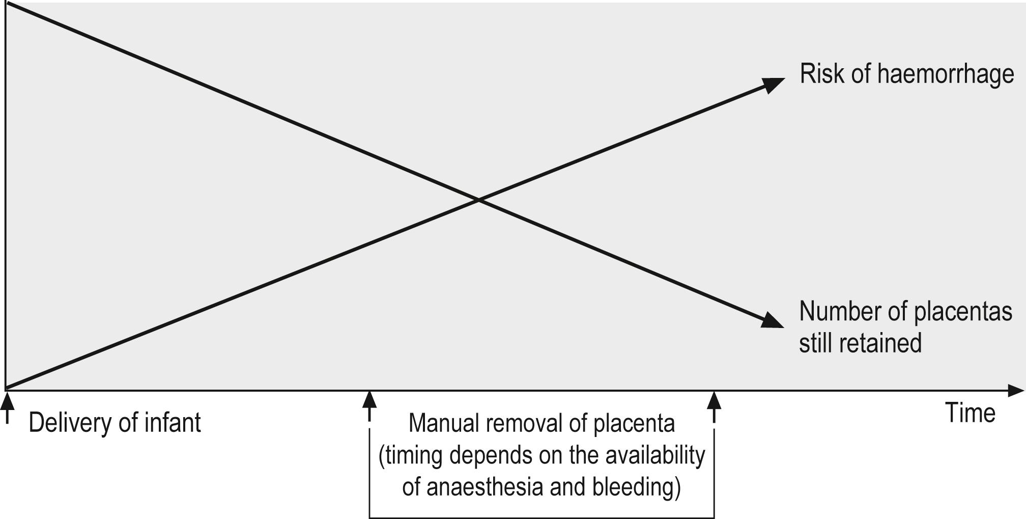 Retained Placenta - Clinical Tree