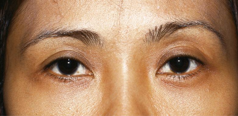 Revision Parameters - Clinical Tree