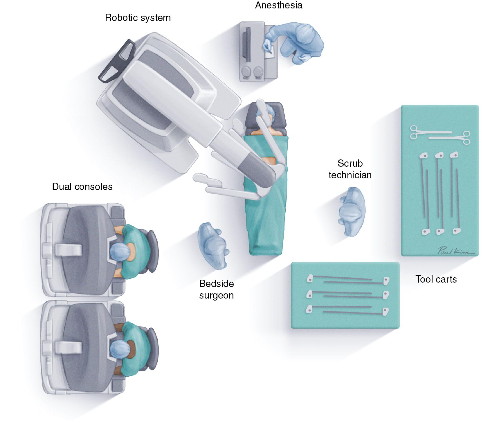 Robotic gastrectomy - Clinical Tree
