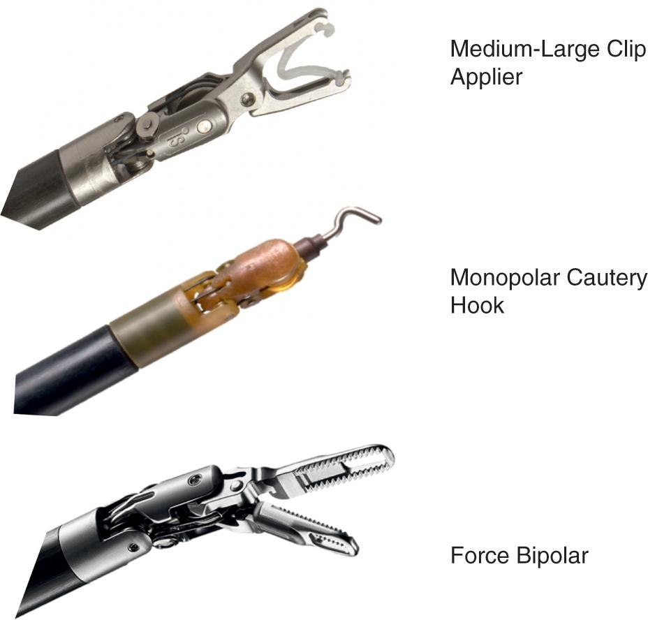 Robotic multiport cholecystectomy - Clinical Tree