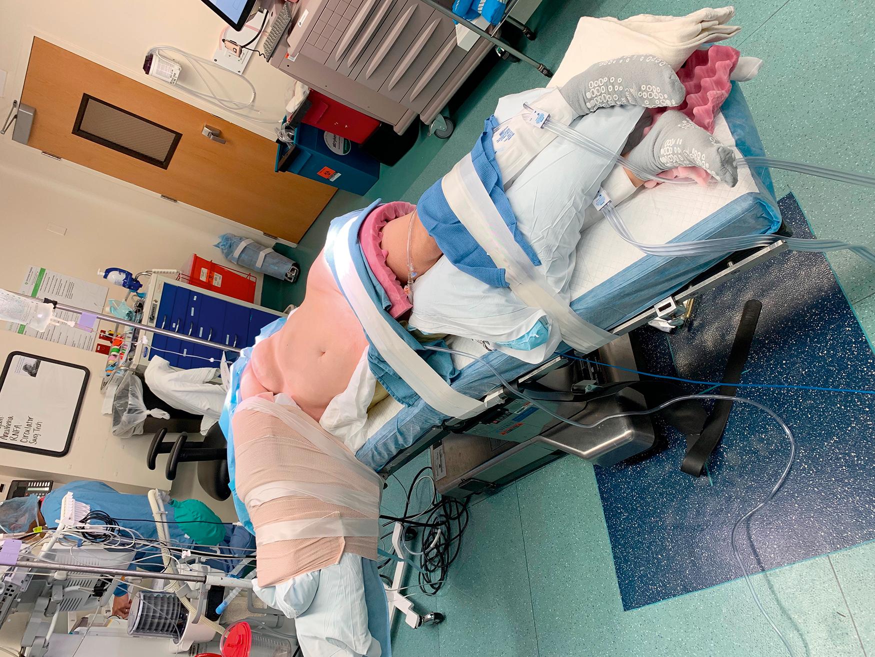 Robotic splenectomy - Clinical Tree