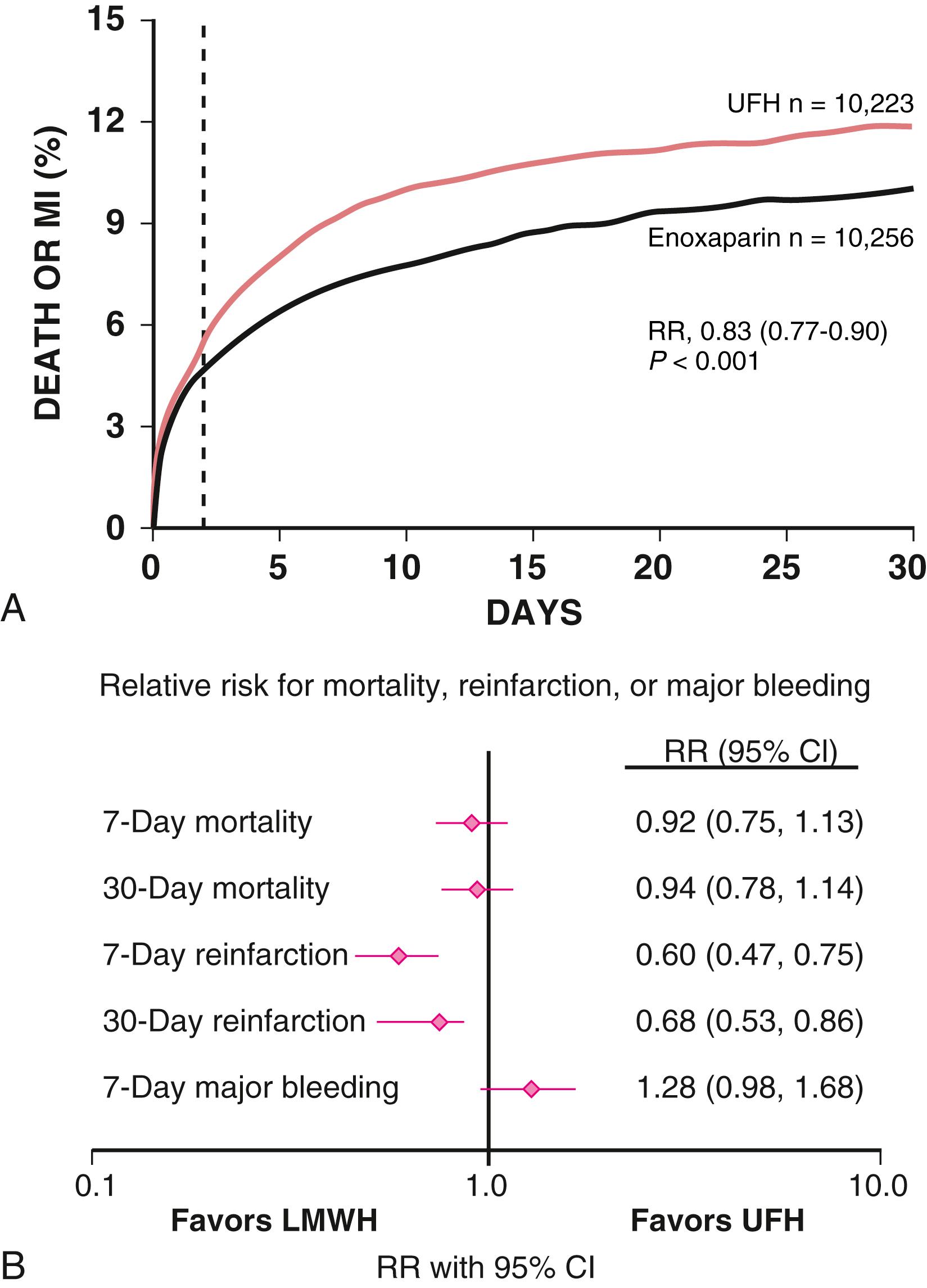 ST-Elevation Myocardial Infarction: Management - Clinical Tree