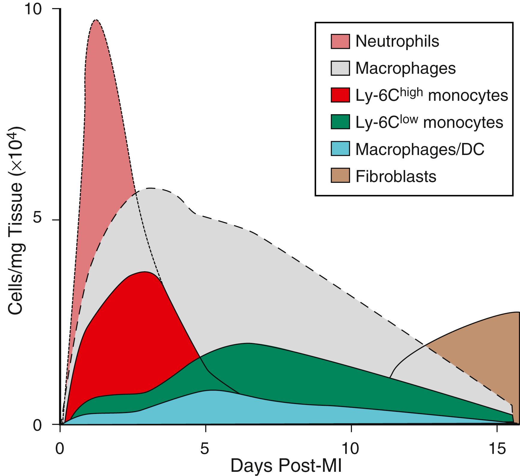 ST-Elevation Myocardial Infarction: Pathophysiology and Clinical ...