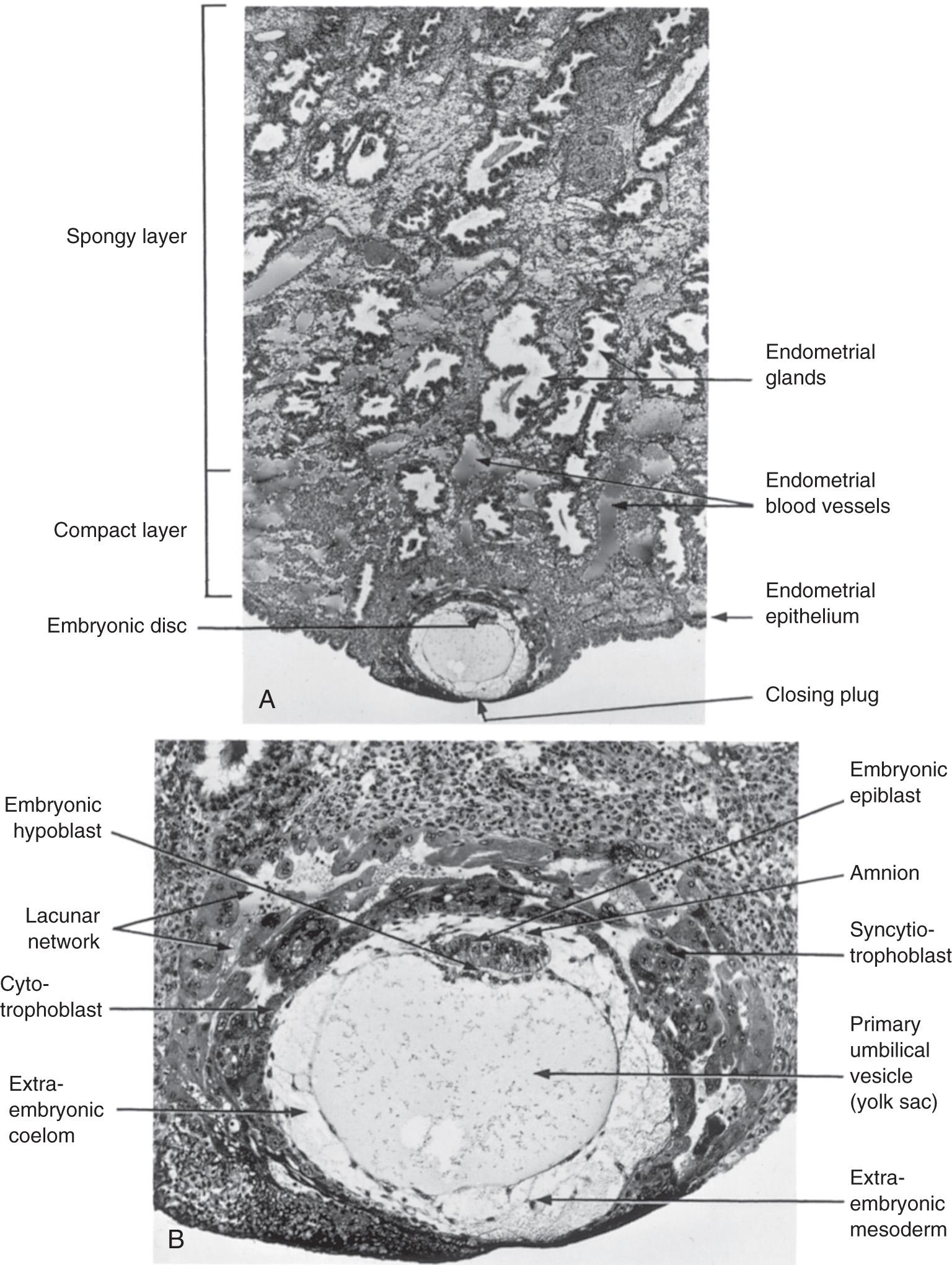 Second Week of Human Development - Clinical Tree