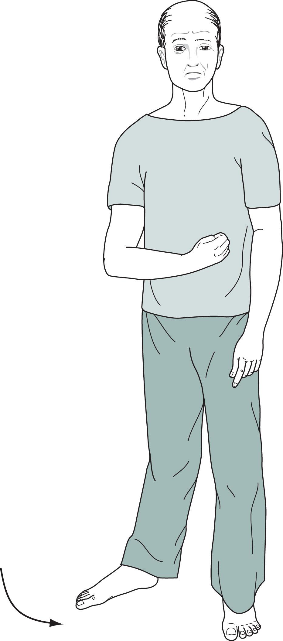 Signs of Central Nervous System Disorders - Clinical Tree