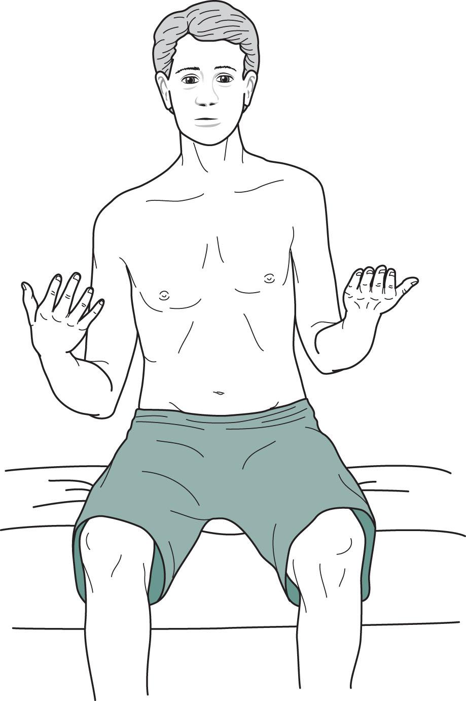 Signs of Central Nervous System Disorders - Clinical Tree