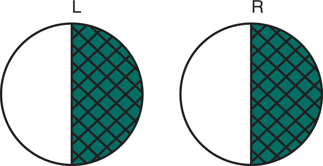 Signs of Central Nervous System Disorders - Clinical Tree