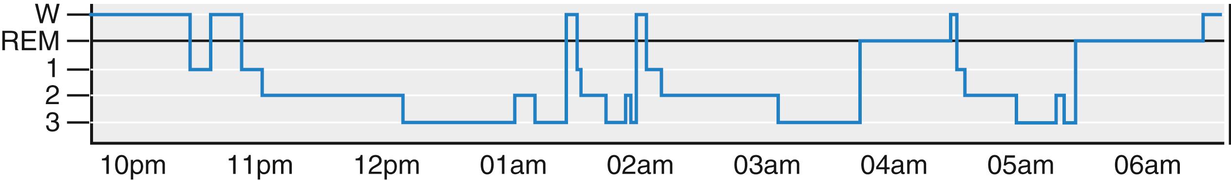 Sleep Medicine - Clinical Tree
