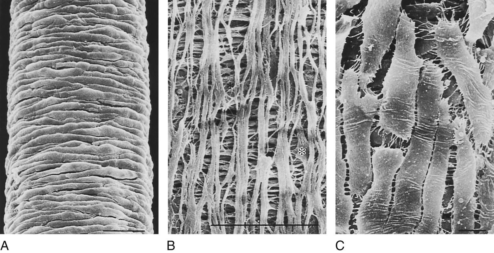Smooth Muscle - Clinical Tree