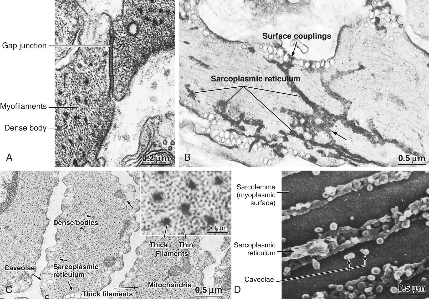 Smooth Muscle - Clinical Tree