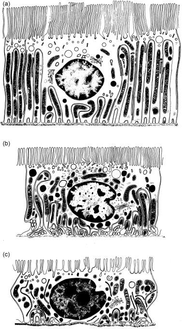 Sodium and Chloride Transport: Proximal Nephron - Clinical Tree