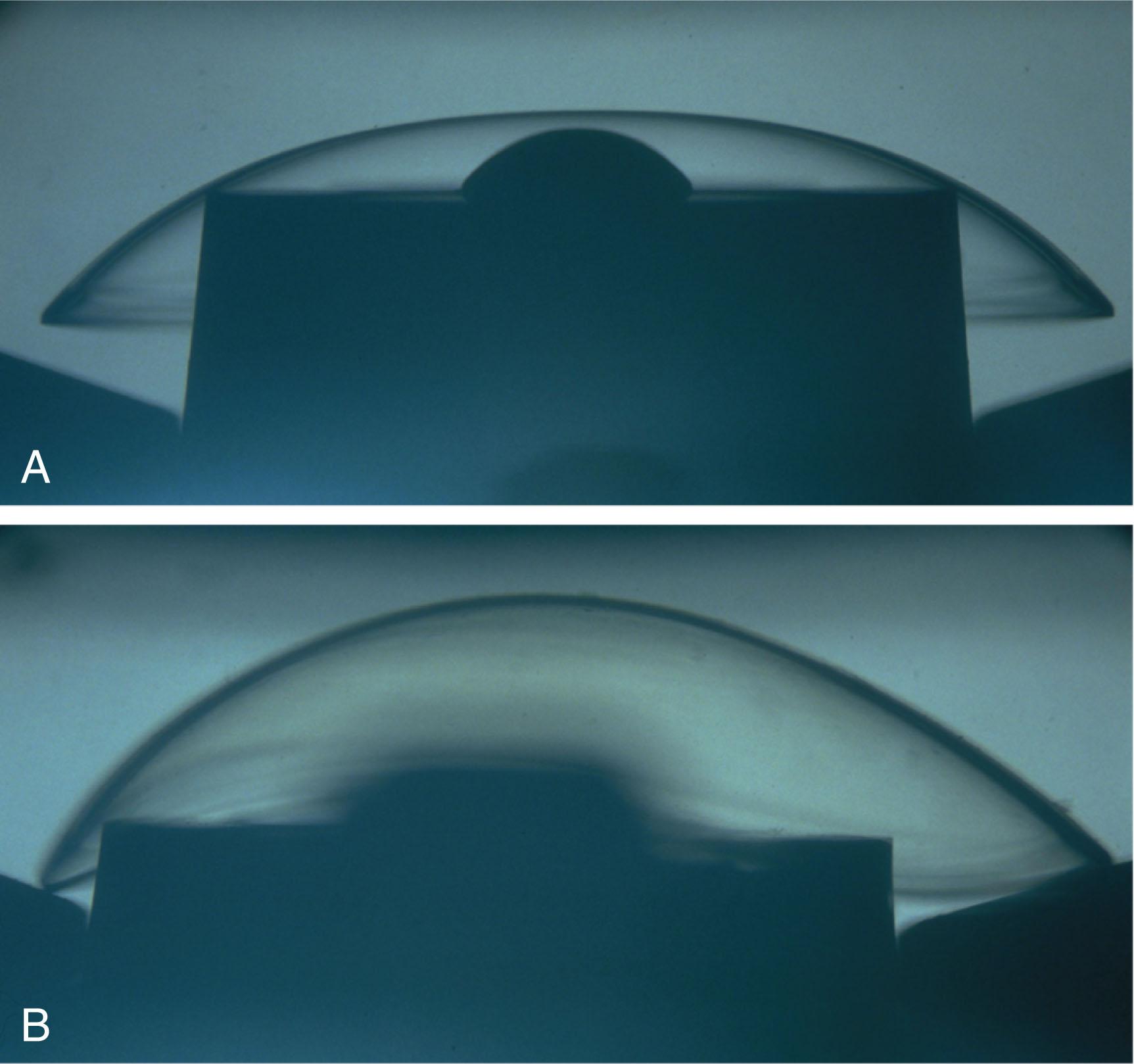 Soft Lens Care Systems - Clinical Tree