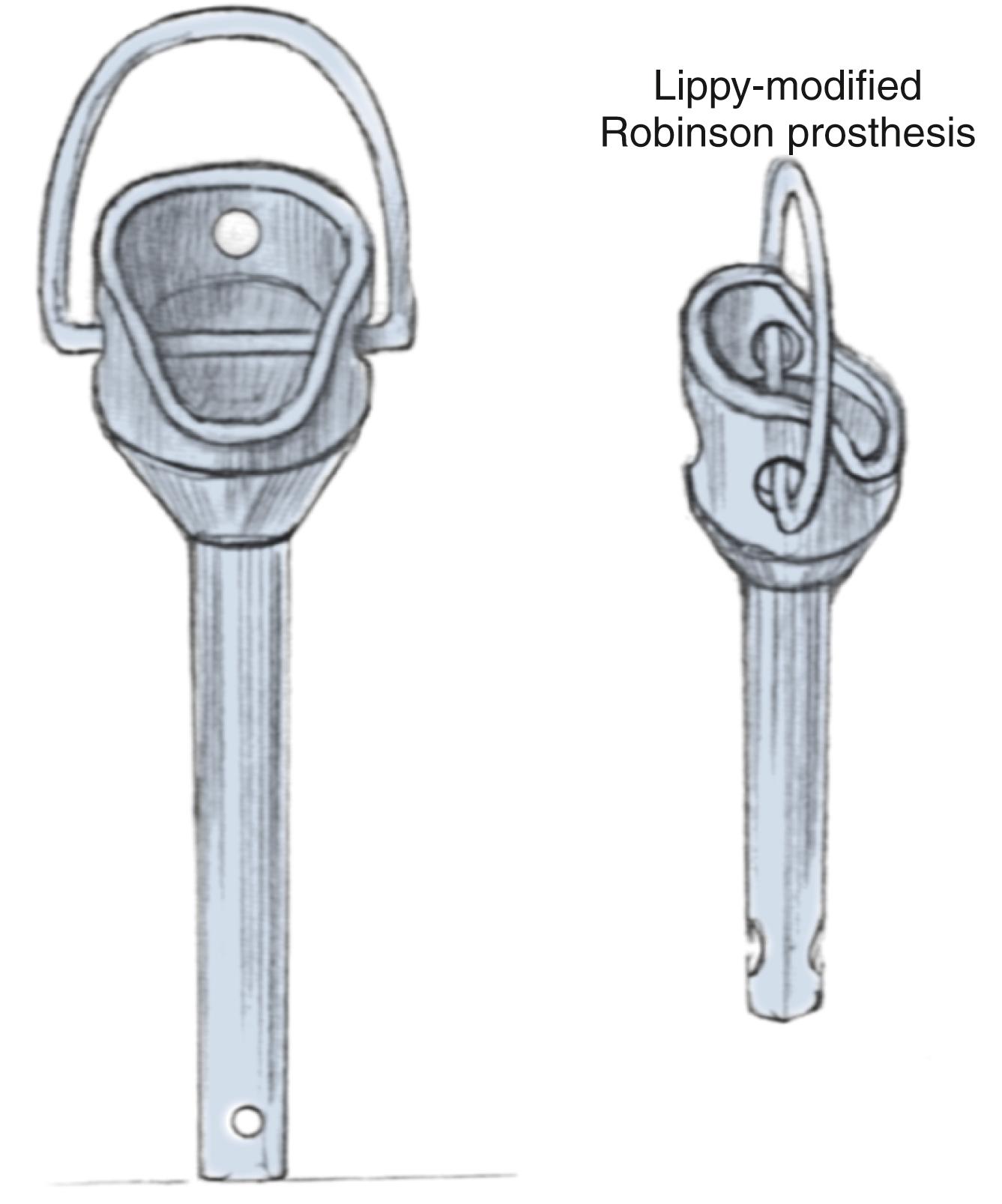 Special Problems of Otosclerosis Surgery - Clinical Tree