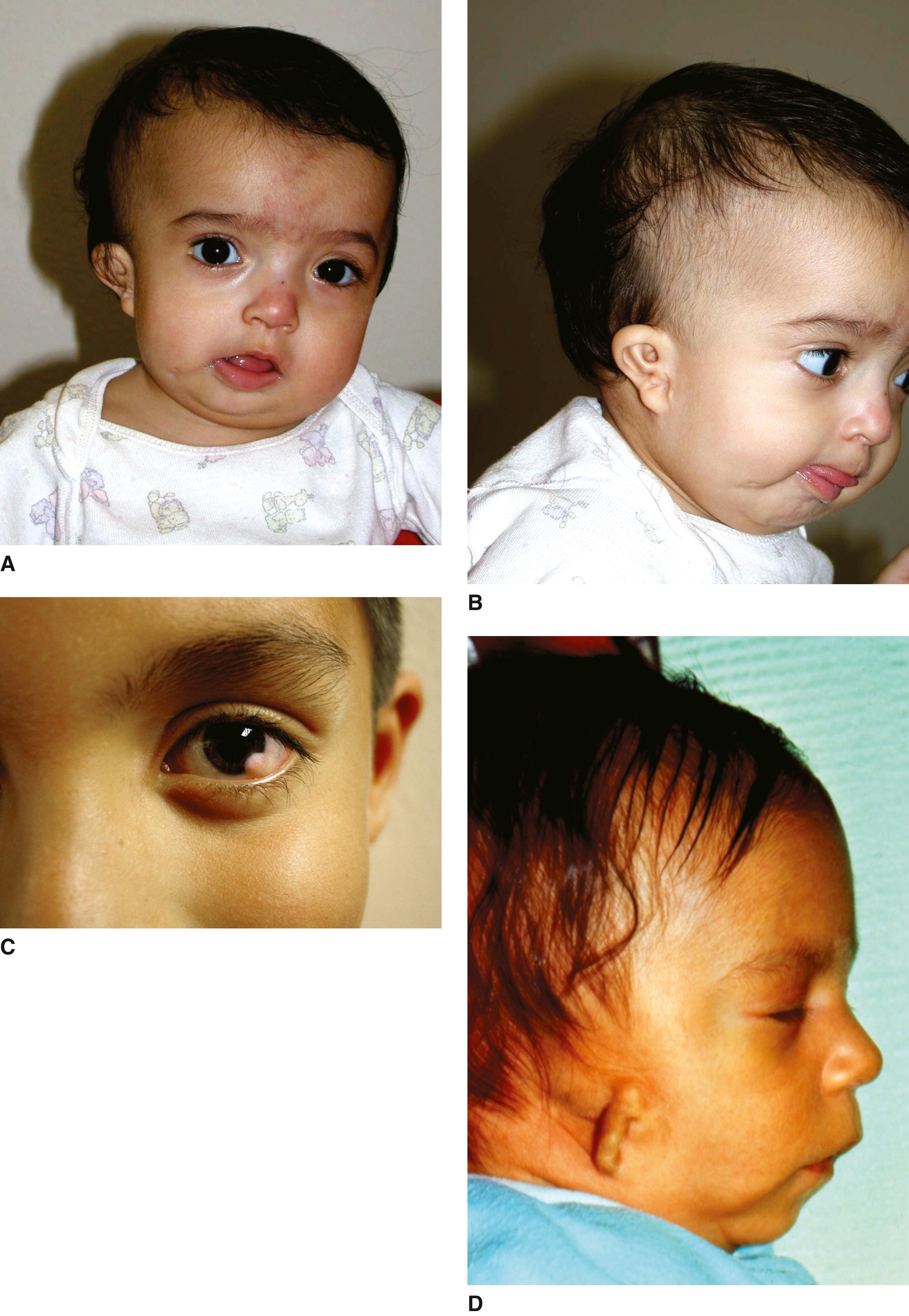 Spectra of Defects - Clinical Tree